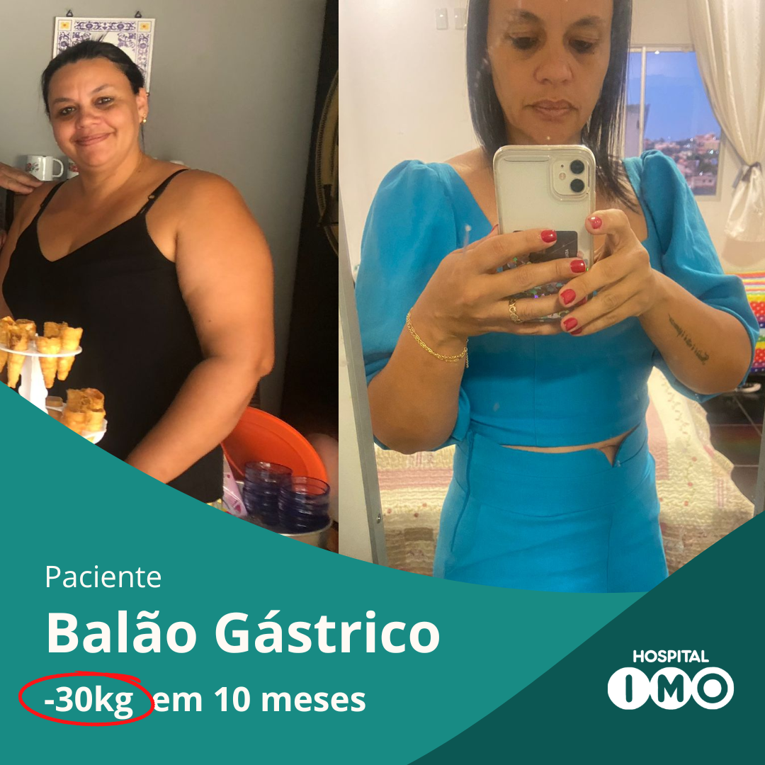 balao intragastrico BH - IMO